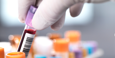 Integrative Bio-Health Support and Private Testing - Positive IV